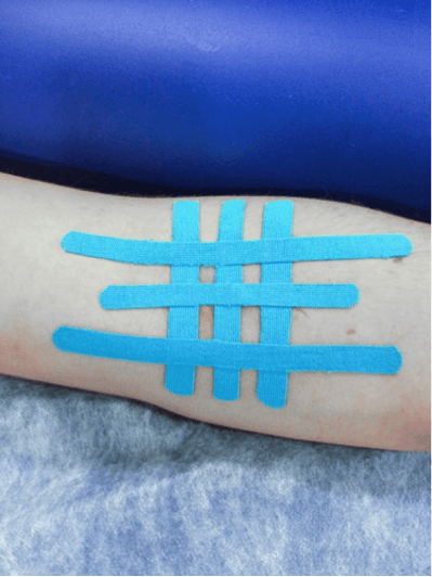 Taping Lombare e per la Schiena – ProTape